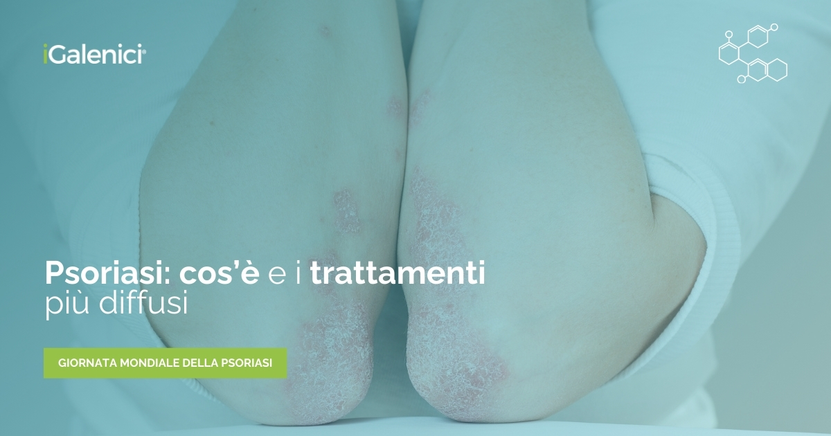 Giornata Mondiale della psoriasi: che cosa è e i trattamenti ...